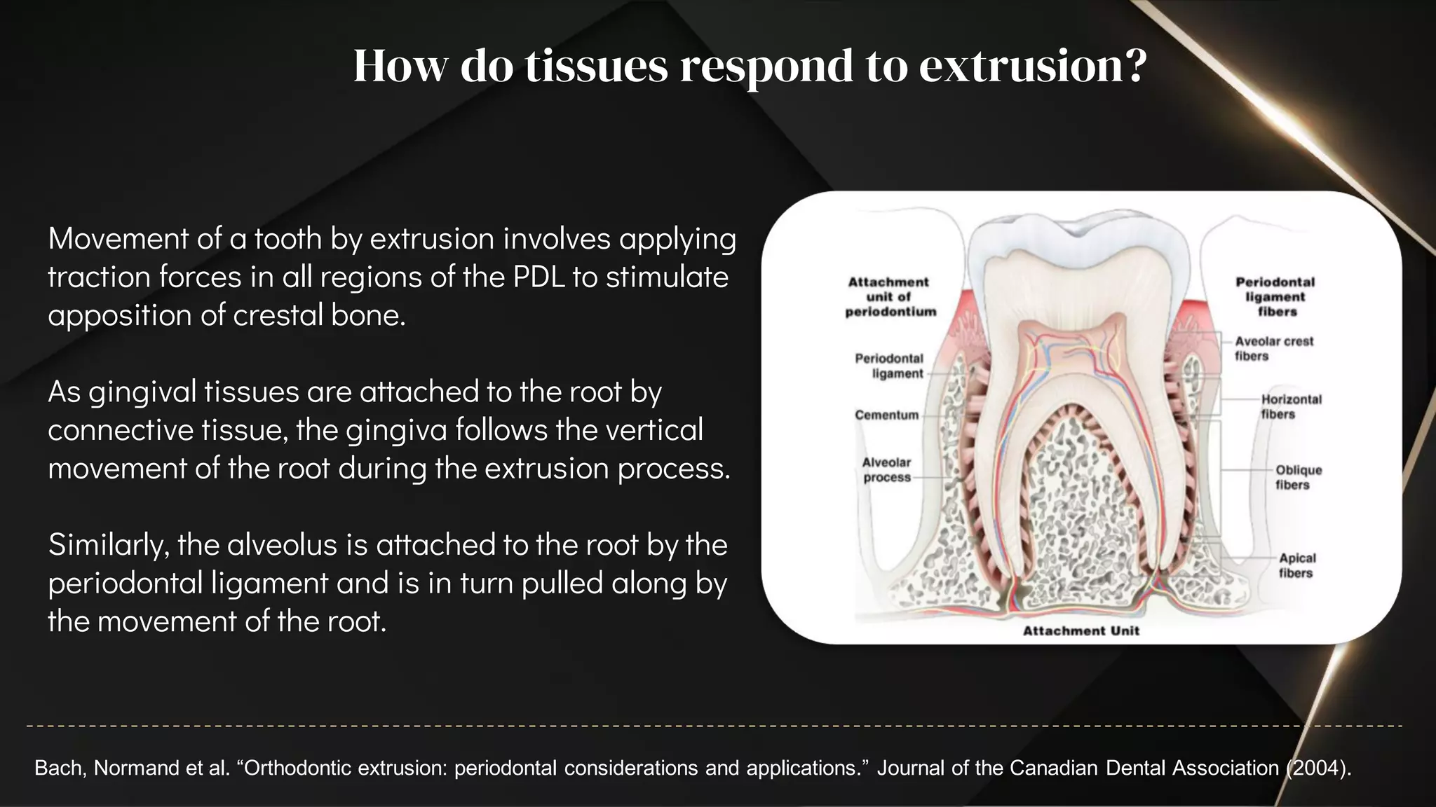 Orthodontic Extrusion | PDF