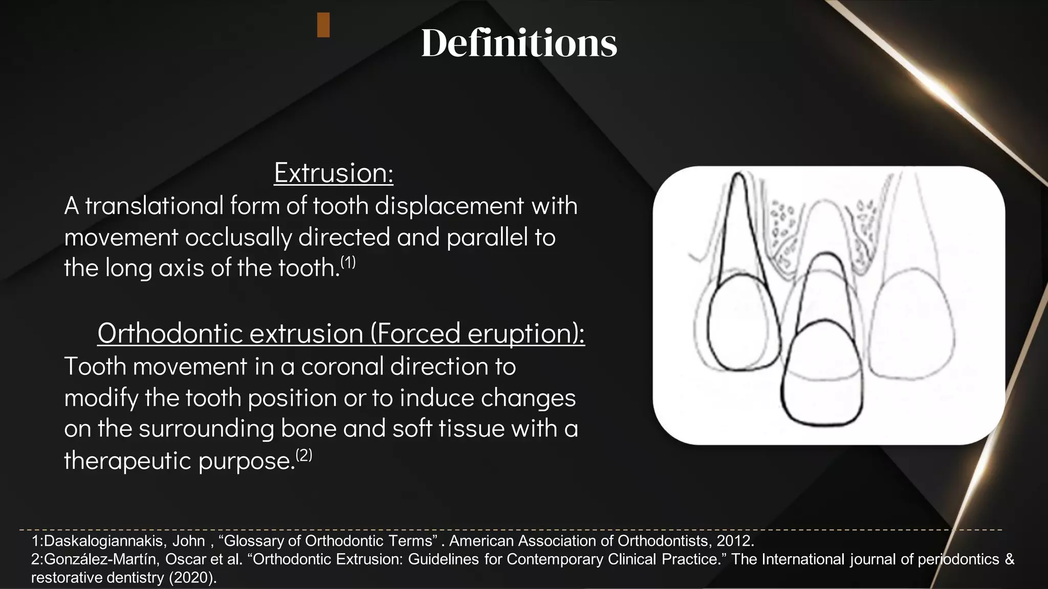 Orthodontic Extrusion | PDF