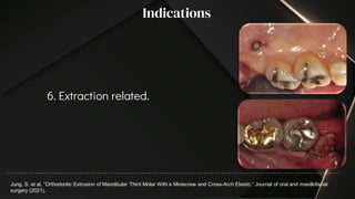 Orthodontic Extrusion | PDF
