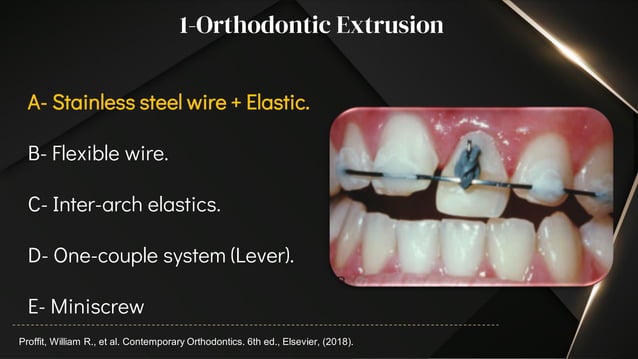 Orthodontic Extrusion | PDF