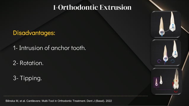 Orthodontic Extrusion | PDF