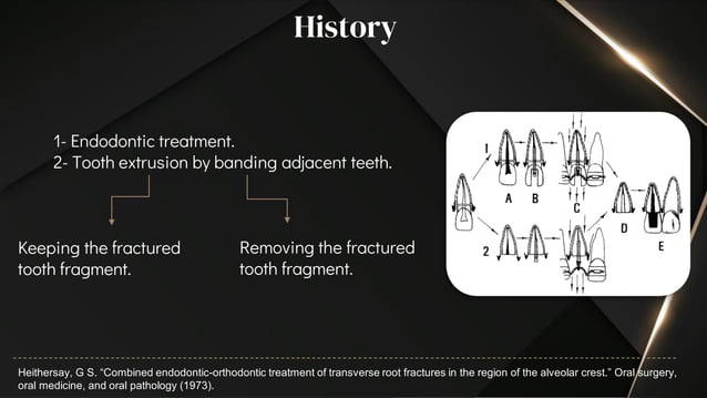 Orthodontic Extrusion | PDF