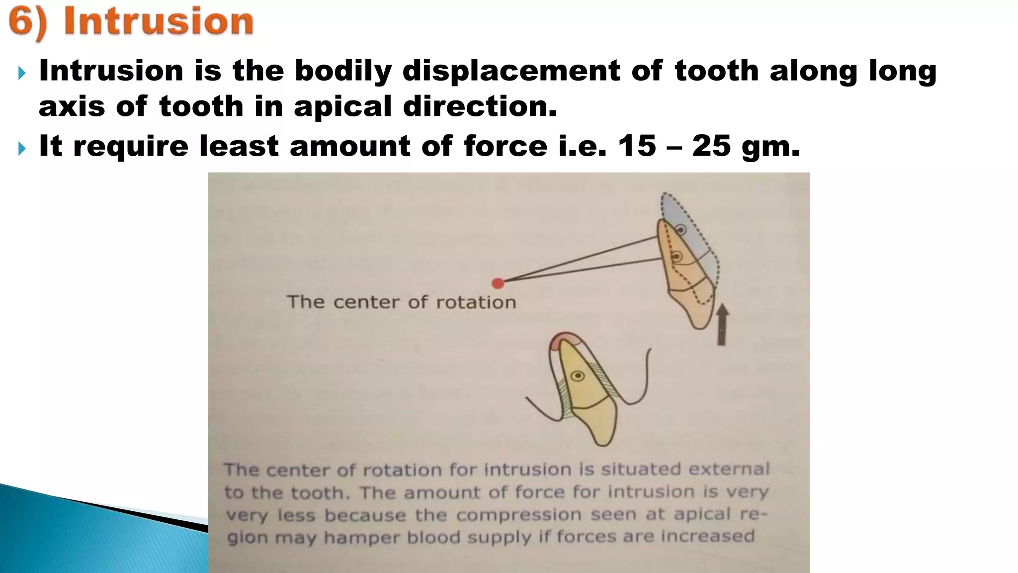 Orthodontic fixed appliances | PPTX