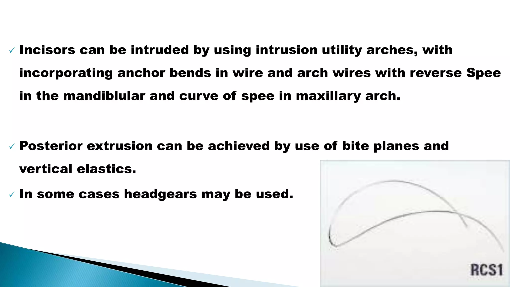 Orthodontic fixed appliances | PPTX