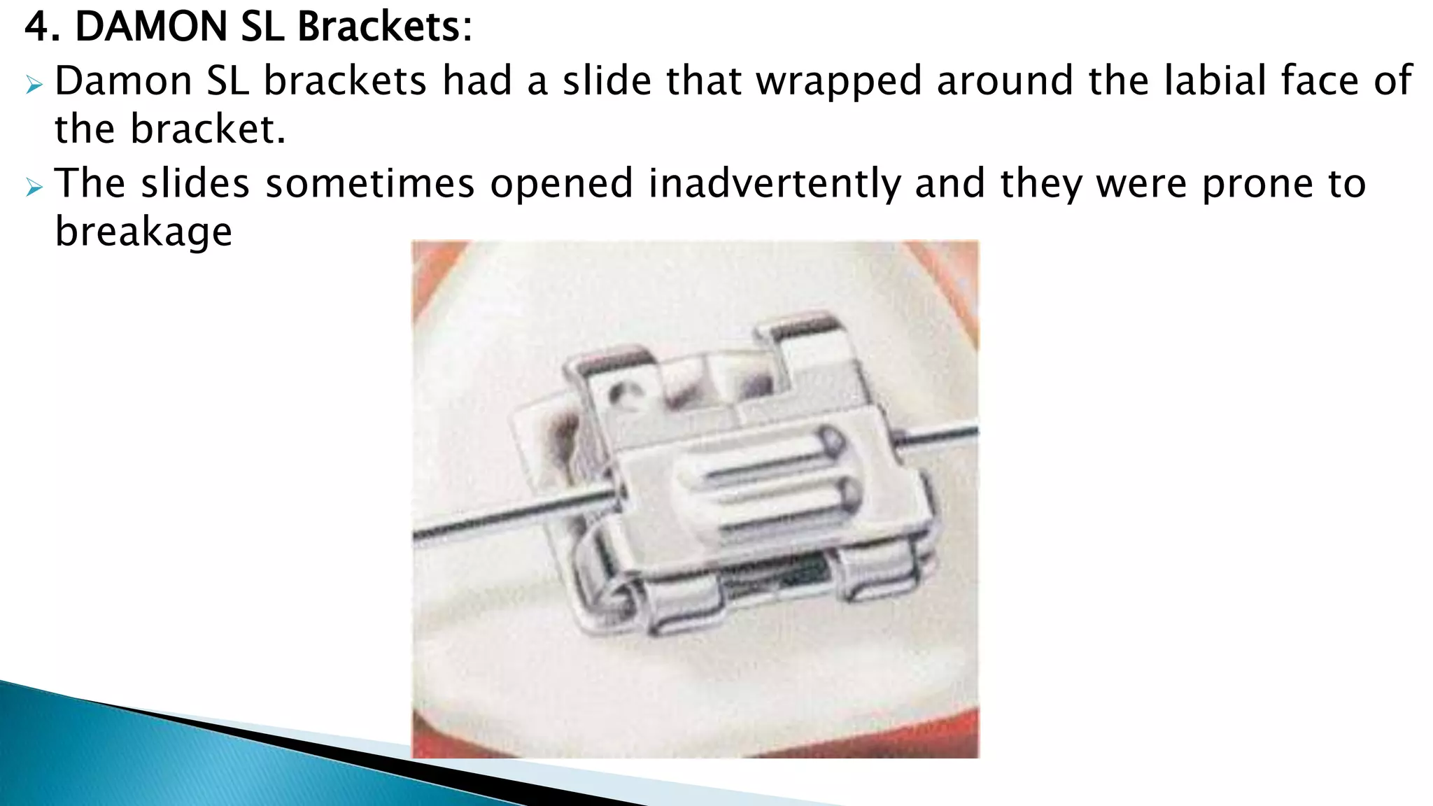 Orthodontic fixed appliances | PPTX