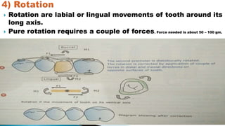 Orthodontic fixed appliances | PPTX
