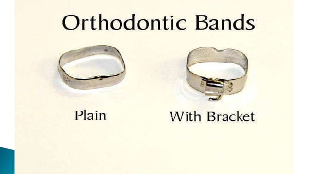 Orthodontic fixed appliances | PPTX | Dental Health | Diseases and ...
