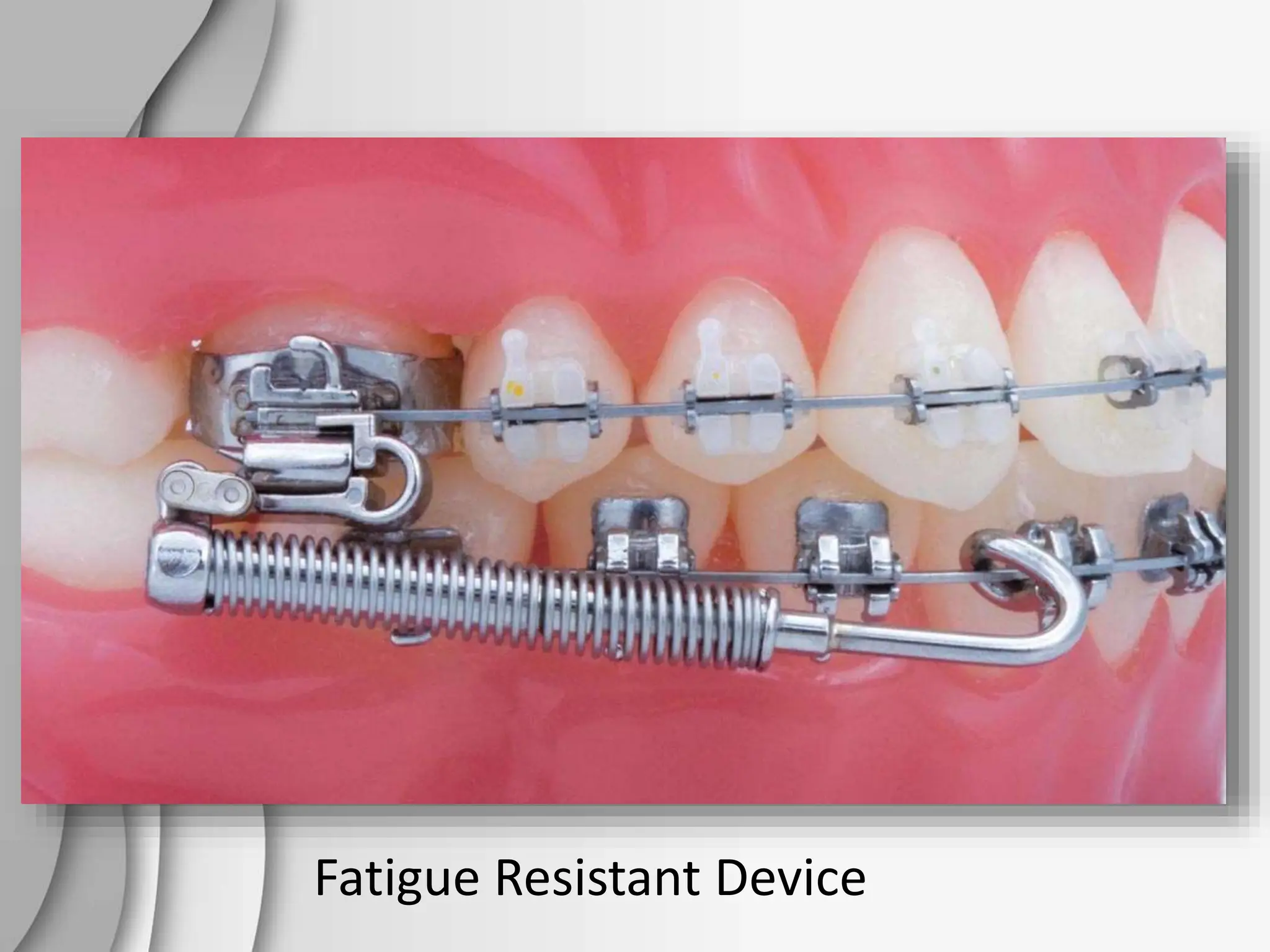 Orthodontic Forsus Fatigue Resistant Device.pptx