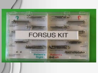 Orthodontic Forsus Fatigue Resistant Device.pptx