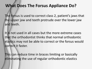 Orthodontic Forsus Fatigue Resistant Device.pptx