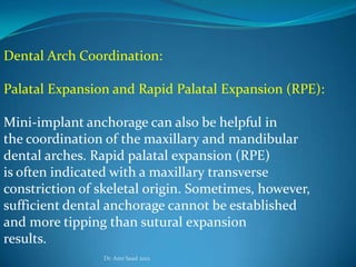 Orthodontic implants | PPT