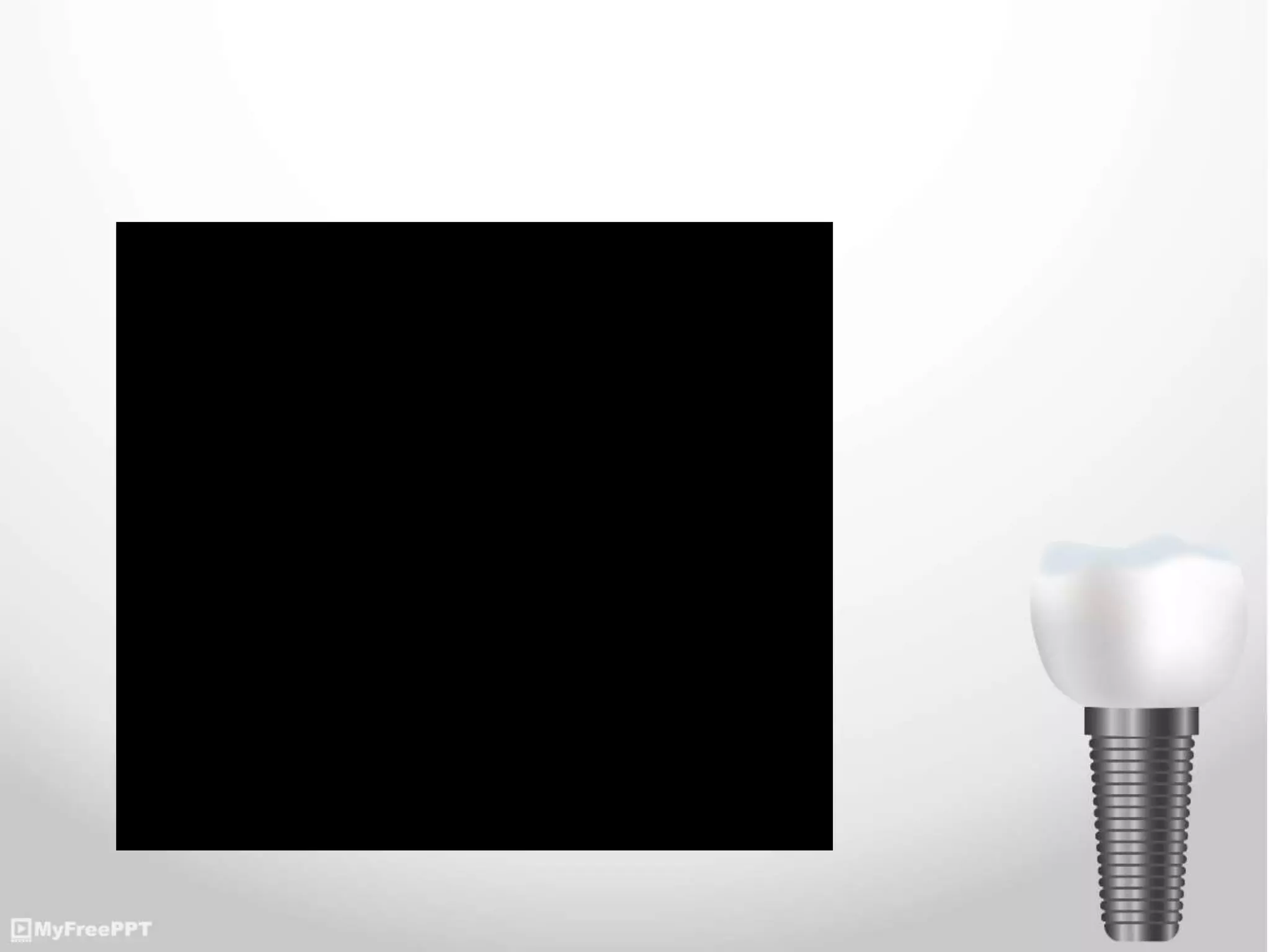 Orthodontic implant seminer | PPTX