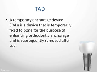 Orthodontic implant seminer | PPT