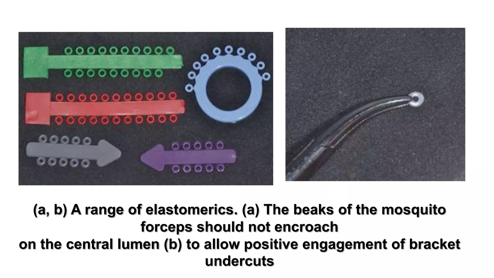 Orthodontic initial alignment of teeth | PPT
