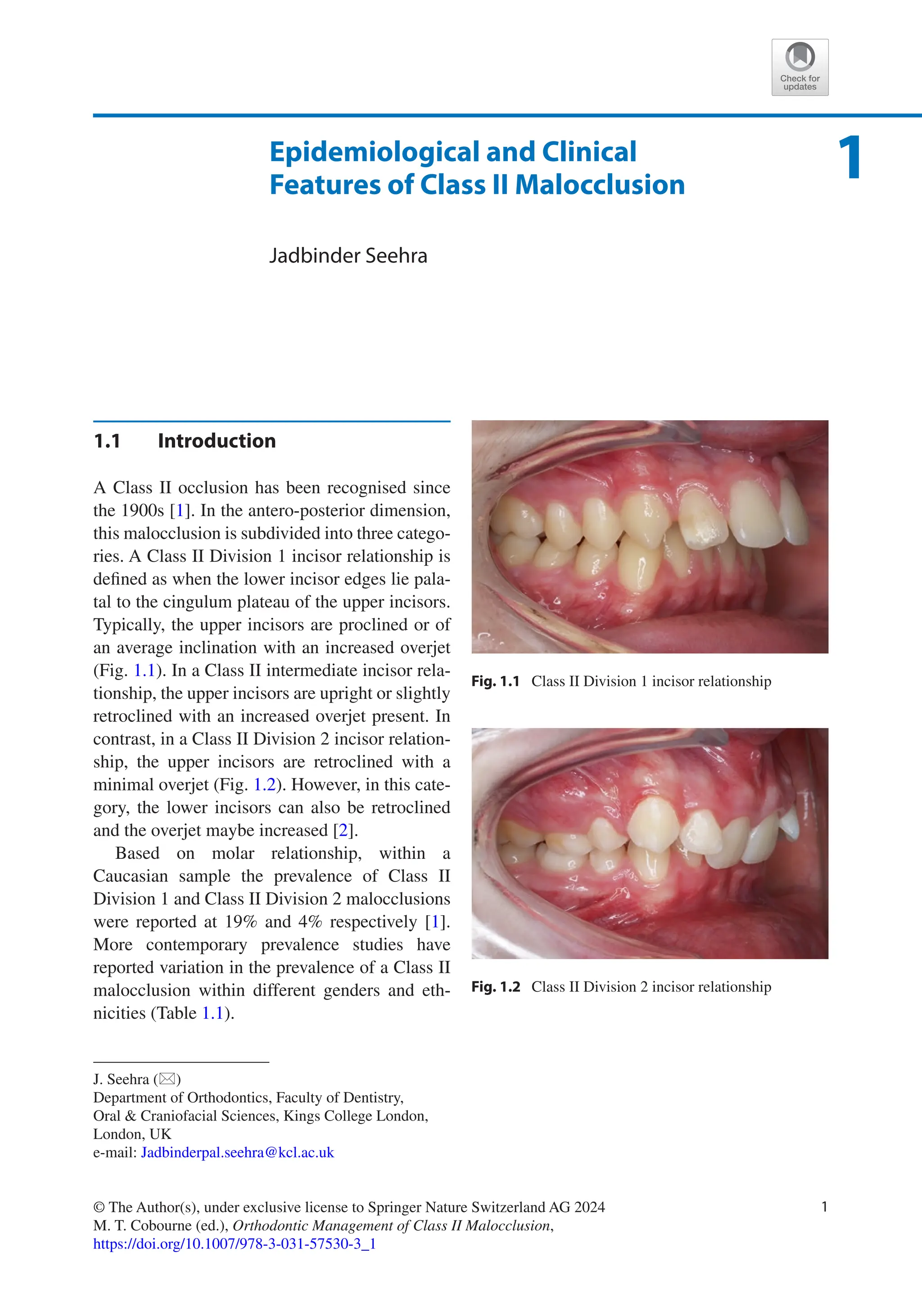 Orthodontic Management of Class II Malocclusion.pdf