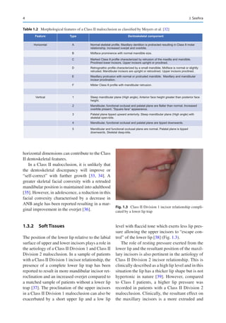 Orthodontic Management of Class II Malocclusion.pdf