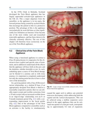 Orthodontic Management of Class II Malocclusion.pdf