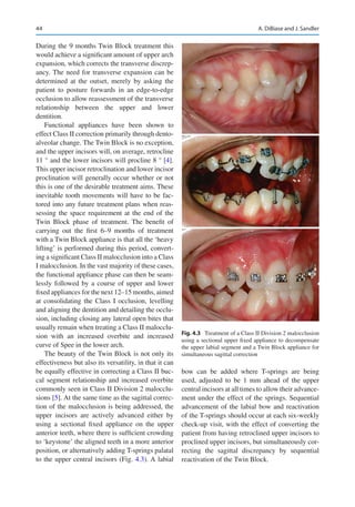 Orthodontic Management of Class II Malocclusion.pdf