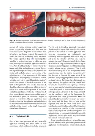 Orthodontic Management of Class II Malocclusion.pdf