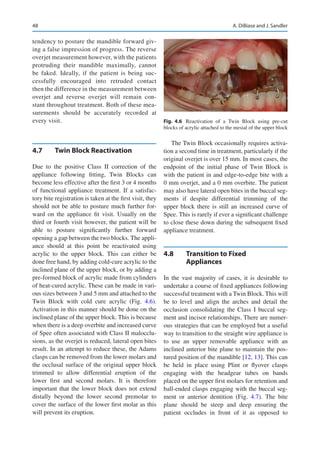 Orthodontic Management of Class II Malocclusion.pdf