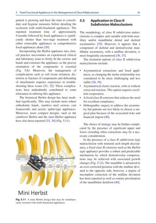 Orthodontic Management of Class II Malocclusion.pdf