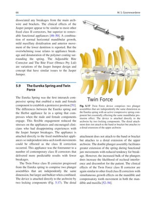 Orthodontic Management of Class II Malocclusion.pdf