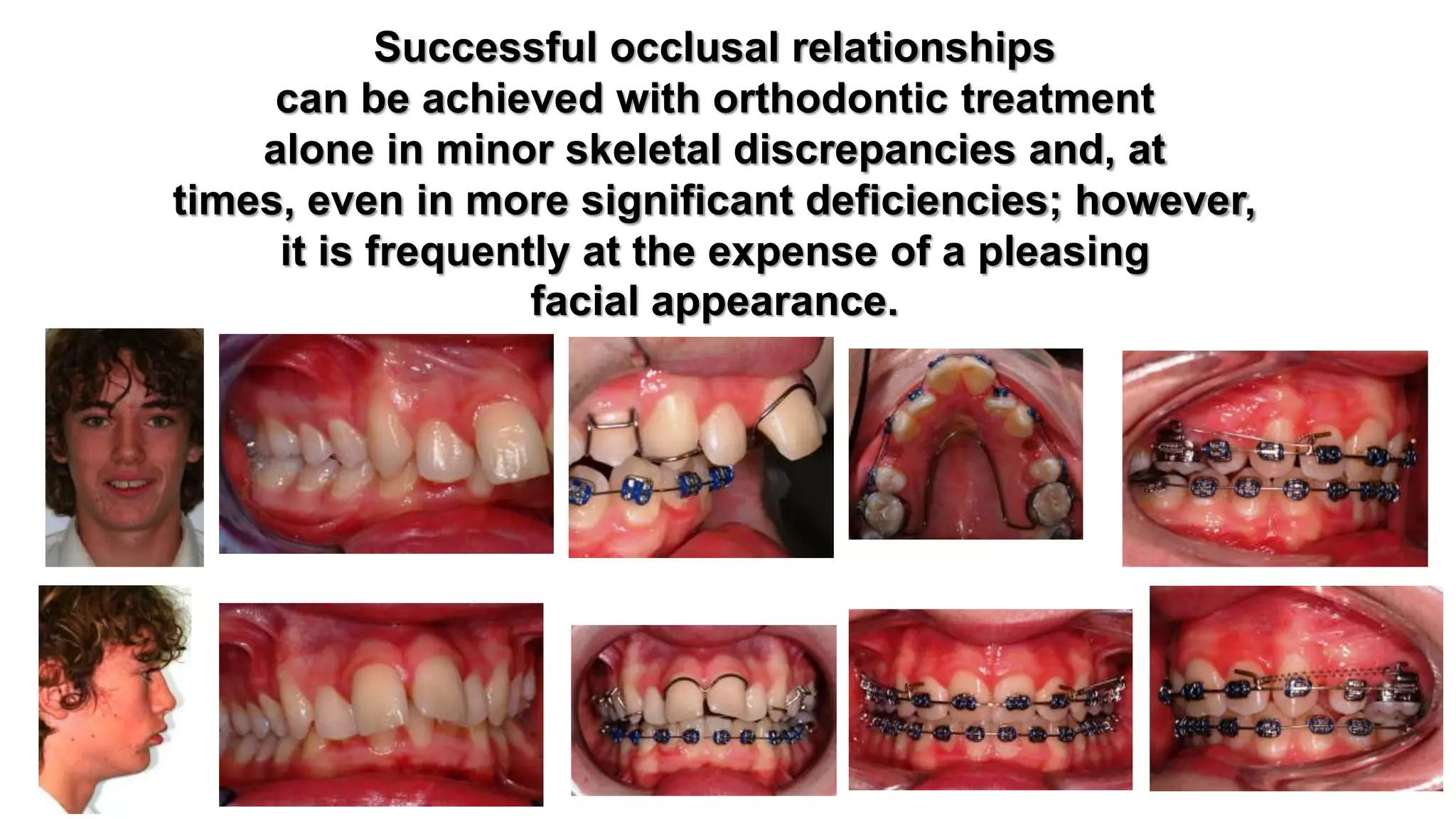 Orthodontic management of dentofacial skeletal problems | PPTX