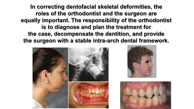 Orthodontic management of dentofacial skeletal problems | PPT