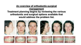 Orthodontic management of dentofacial skeletal problems | PPTX