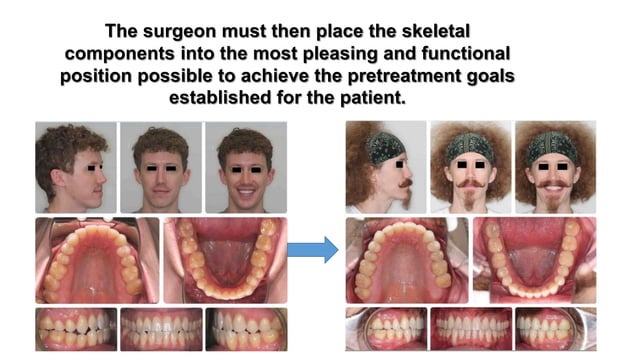 Orthodontic management of dentofacial skeletal problems | PPT