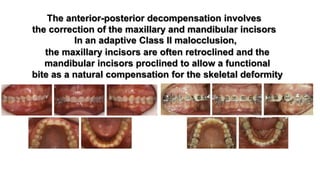 Orthodontic management of dentofacial skeletal problems | PPTX