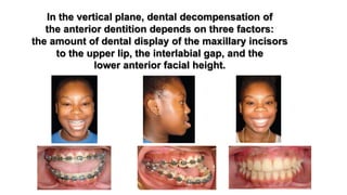 Orthodontic management of dentofacial skeletal problems | PPTX
