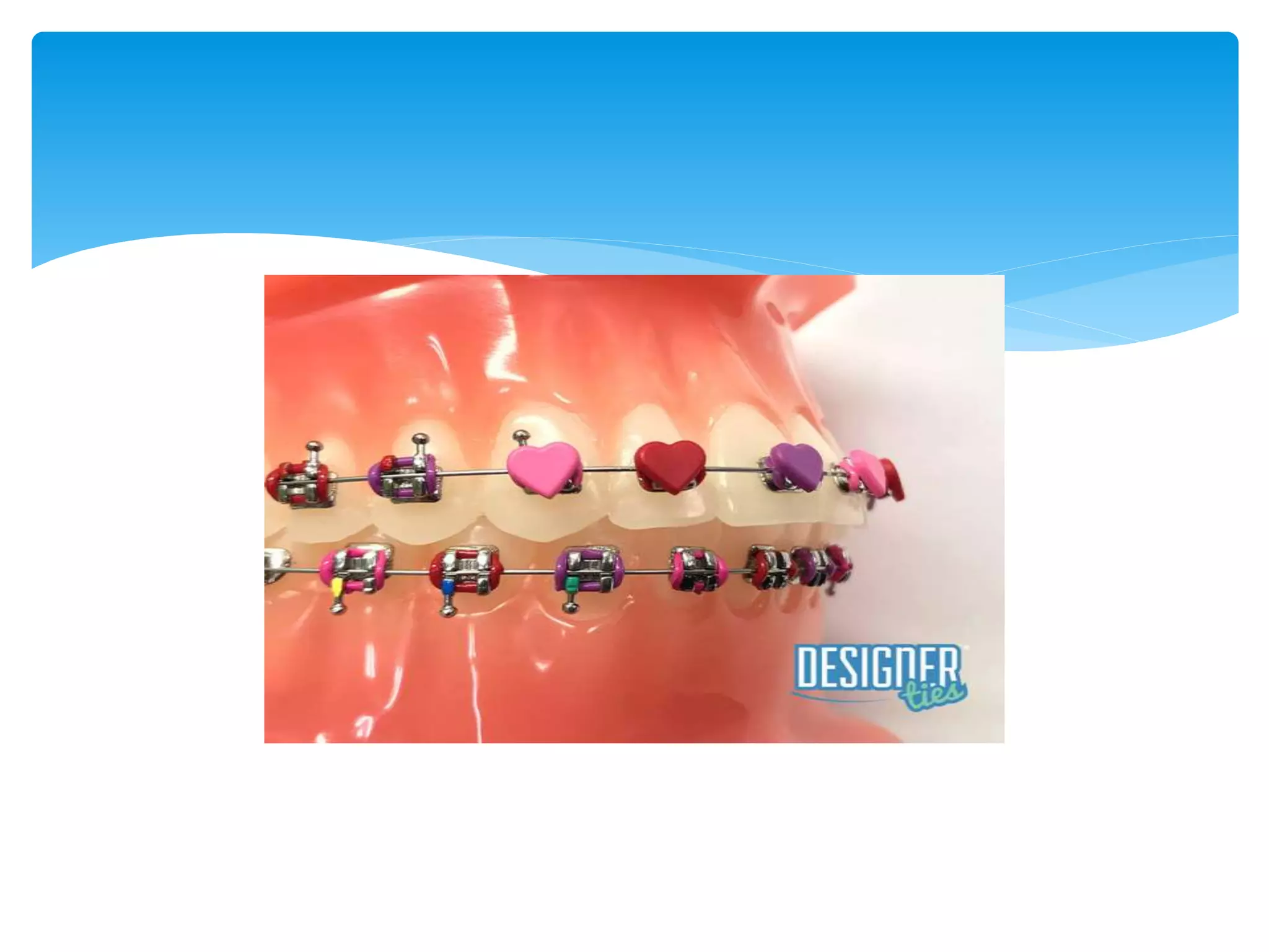 Orthodontic materials & instruments | PPTX
