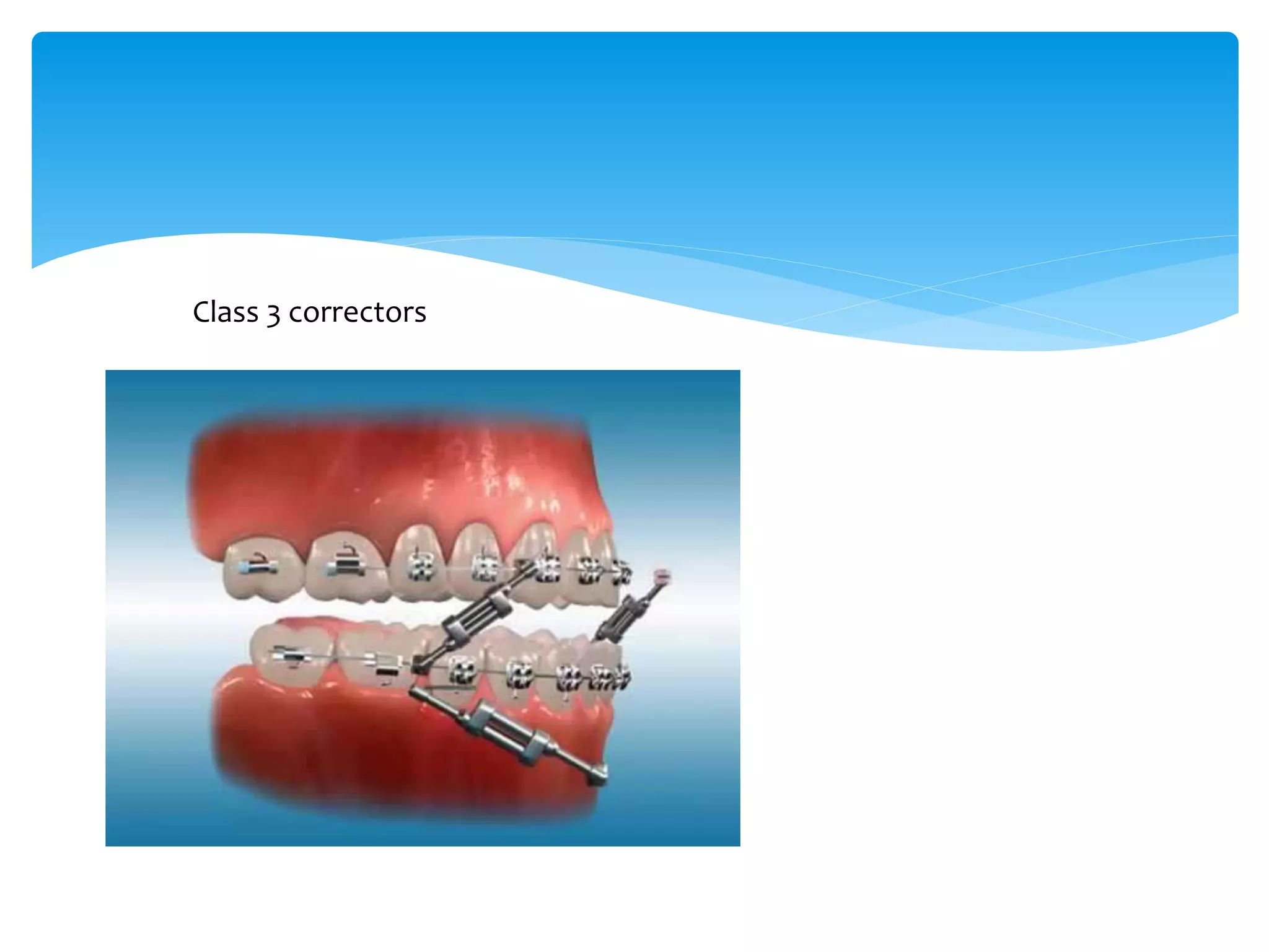 Orthodontic materials & instruments | PPTX