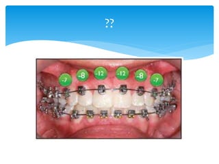 Orthodontic materials & instruments | PPTX
