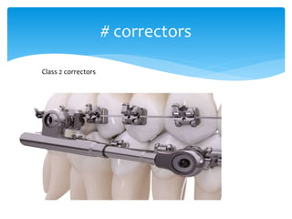 Orthodontic materials & instruments | PPTX