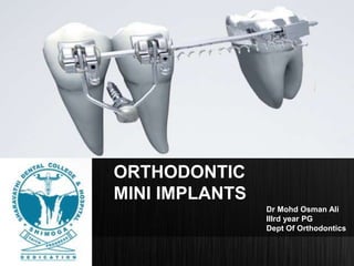 IMPLANTS IN ORTHODONTICS | PPTX