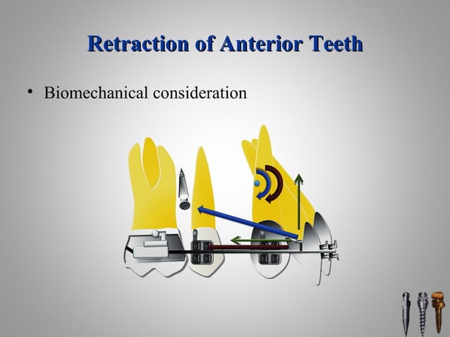 Orthodontic miniscrew implants | PPT