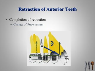 Orthodontic miniscrew implants | PPT