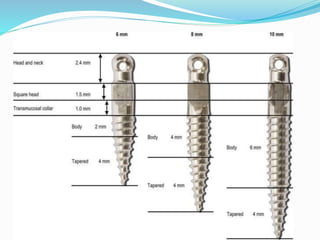 Orthodontic miniscrew ( TAD ) placement | PPTX