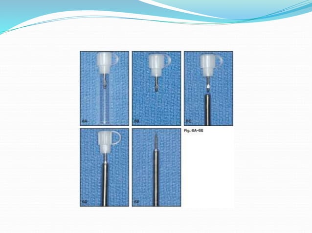 Orthodontic miniscrew ( TAD ) placement | PPTX