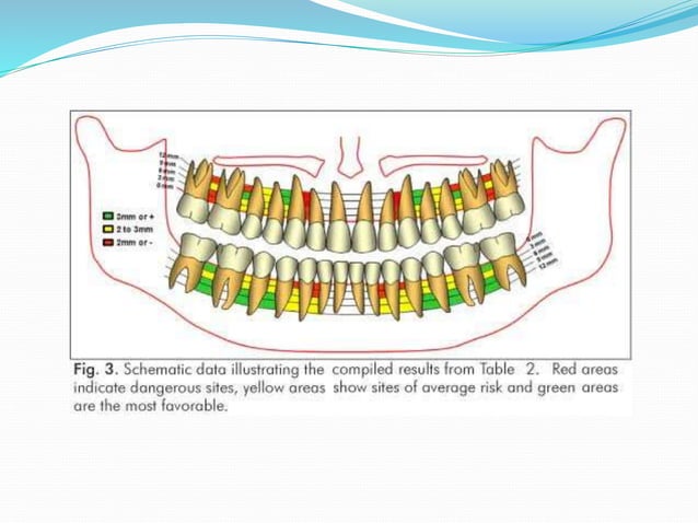 Orthodontic miniscrew ( TAD ) placement | PPTX