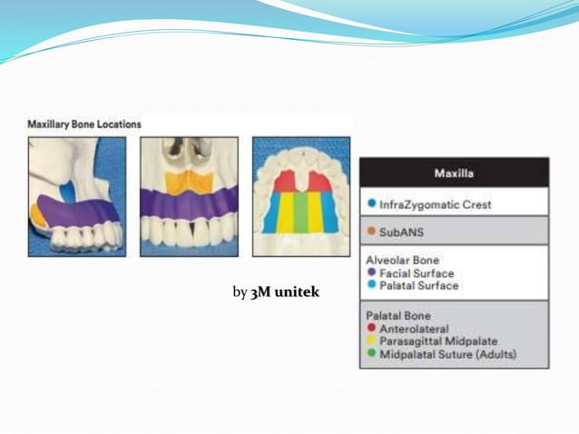 Orthodontic miniscrew ( TAD ) placement | PPTX