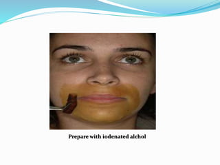 Orthodontic miniscrew ( TAD ) placement | PPTX