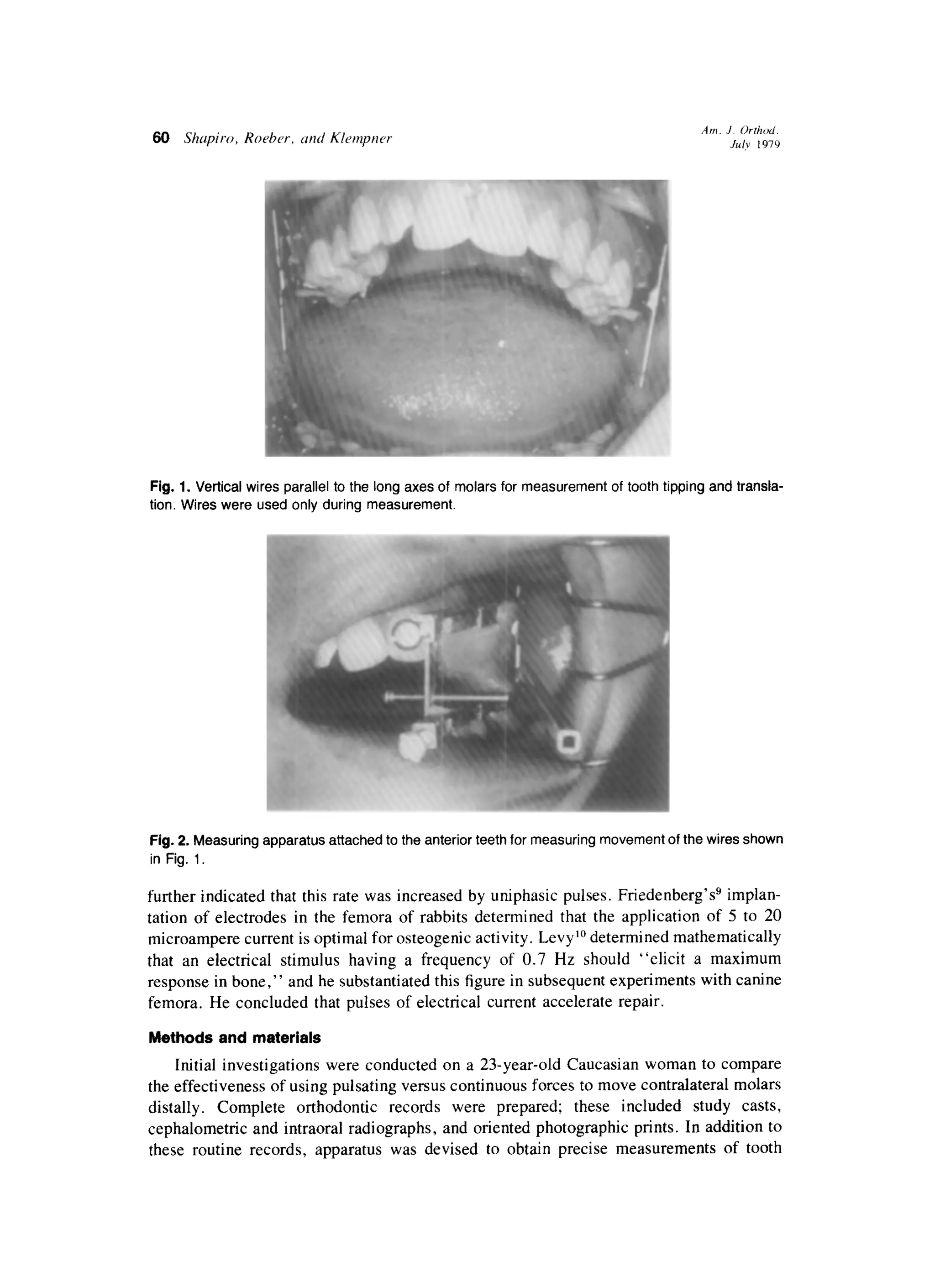 Orthodontic movement using pulsating force induced peizoelctricity | PDF