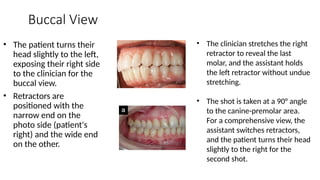 Orthodontic_Picture_Taking final draft.pptx