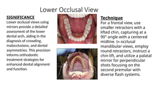 Orthodontic_Picture_Taking final draft.pptx