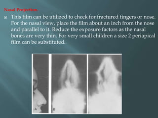 Orthodontic radiograph.. | PPTX