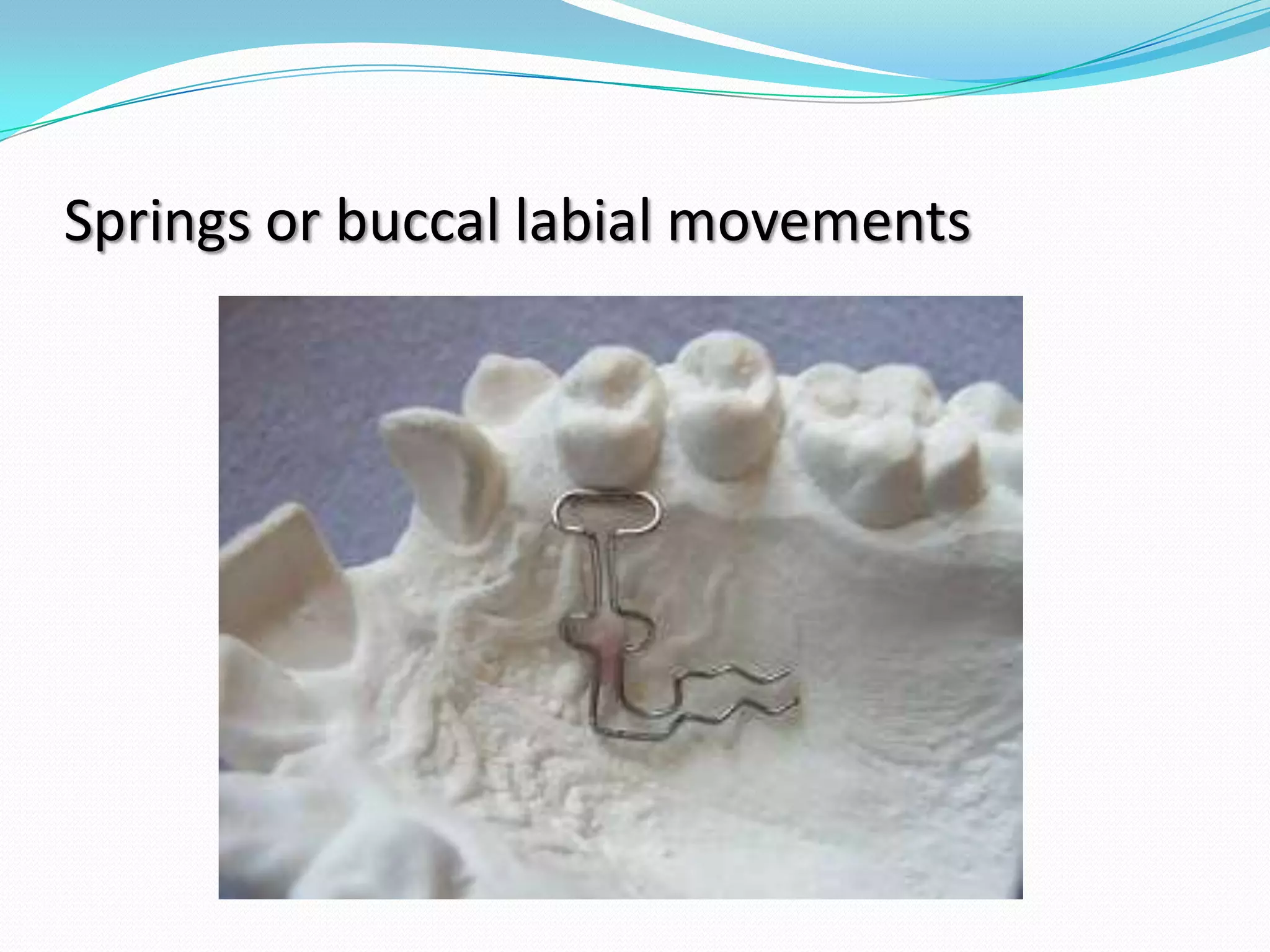 Orthodontic removable appliances