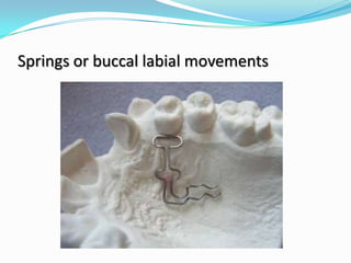 Orthodontic removable appliances | PPT